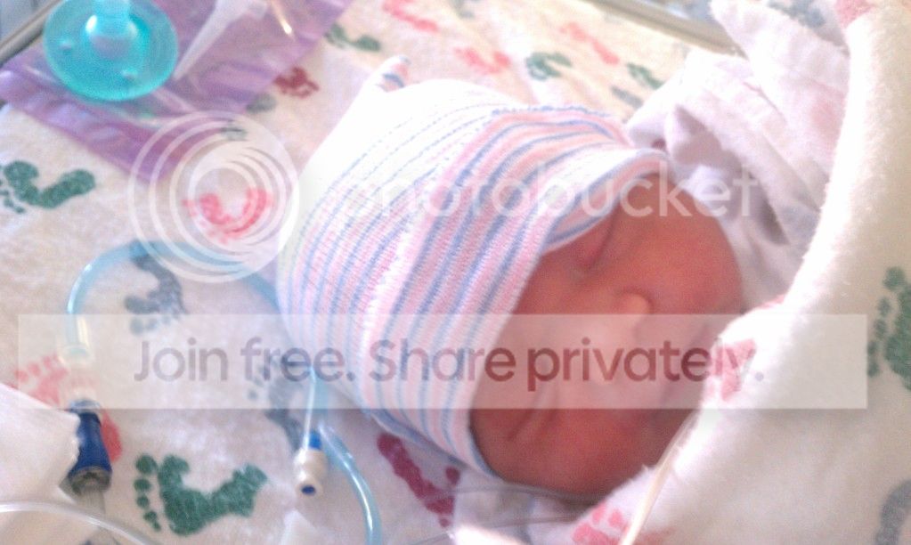 Anyone else's LO have a big blue vein on nose? | BabyCenter