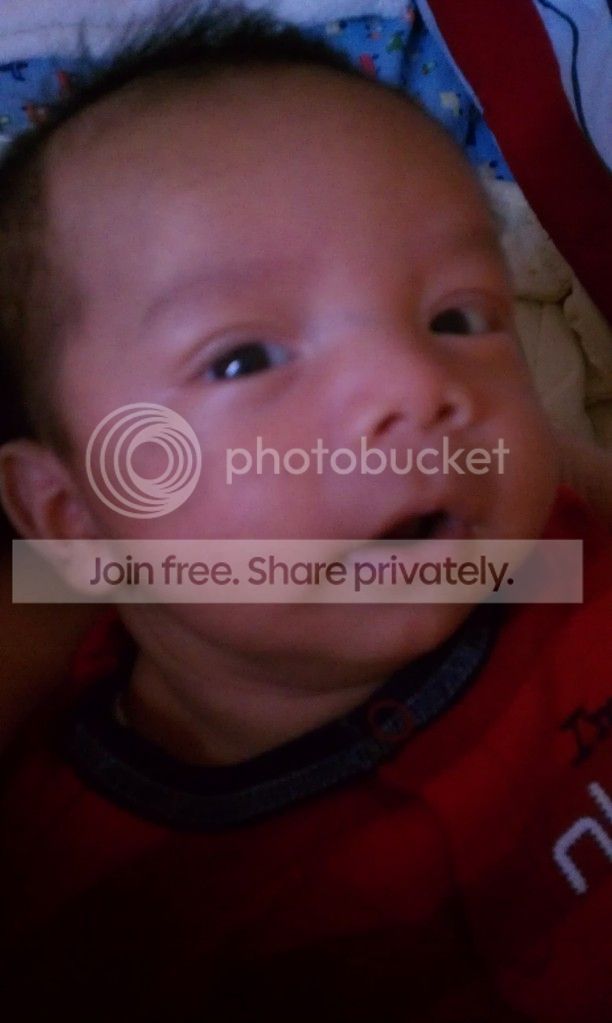 Anyone else's LO have a big blue vein on nose? | BabyCenter